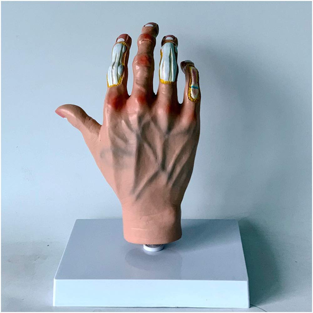 Fhuili Palm Anatomy Models The Anatomical Structure Of The Painful ...