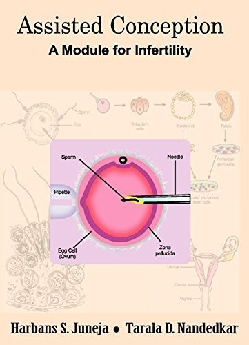 Buy Assisted Conception - a module for infertility Book Online at Low ...