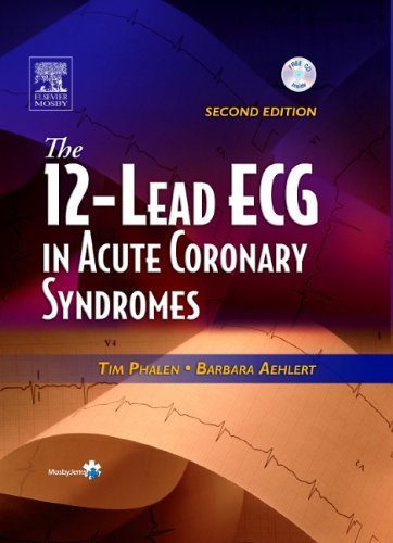 The 12-Lead ECG in Acute Coronary Syndromes Text and Pocket Reference ...