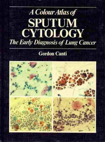 A Colour Atlas of Sputum Cytology: The Early Diagnosis of Lung Cancer ...