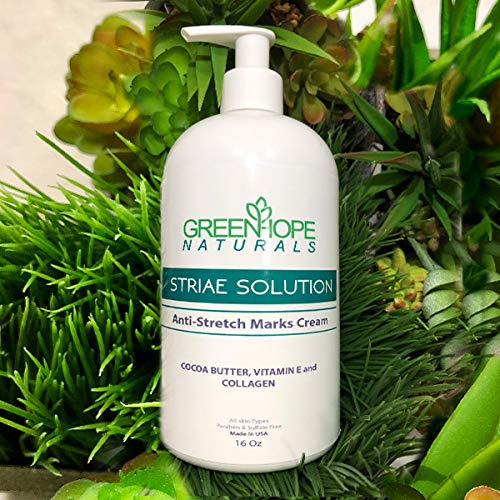 Amazon.com : Striae Solution Cream 16oz : Beauty & Personal Care