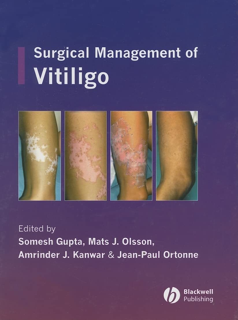 Surgical Management of Vitiligo: 9781405145213: Medicine & Health ...