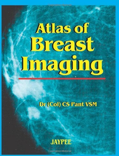 Amazon.com: Atlas of Breast Imaging eBook : Pant, C. S.: Kindle Store