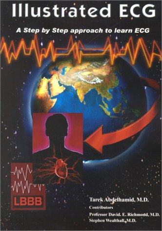 Illustrated ECG: A Step by Step Approach to Learn ECG: Amazon.co.uk ...