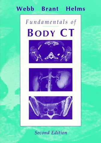 Fundamentals of Body CT (Fundamentals of Radiology): 9780721668628 ...