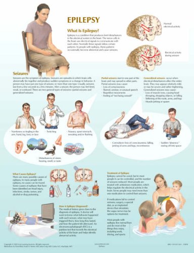 Amazon | Epilepsy Chart, 1e (Netter Charts) | Netter MD, Frank H ...