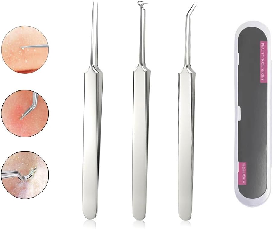 Amazon | 3 ピースにきび除去ツール顔のにきび抽出ツールにきび白にきび傷抽出ツール | XNBDBD | 毛抜き 通販
