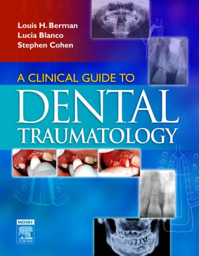 Ebook – A Clinical Guide to Dental Traumatology 1 Edition (PDF Instant ...