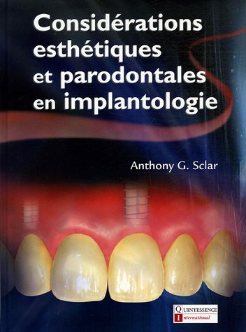 Amazon.fr - Considérations esthétiques et parodontales en implantologie ...