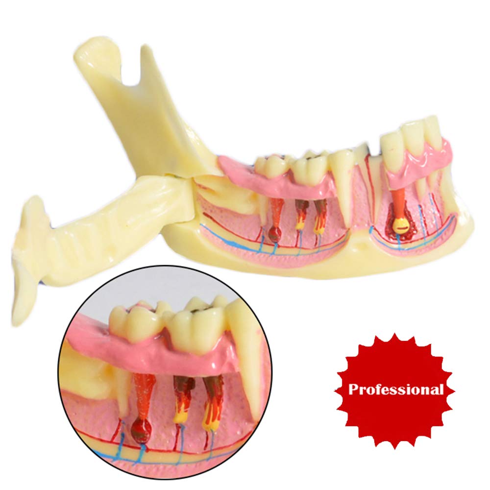 Buy FHUILI Dental Lower Jaw Teeth Model - Dental Teeth Study Teaching ...