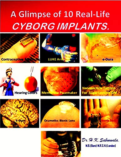 Cyborgs In Real Life