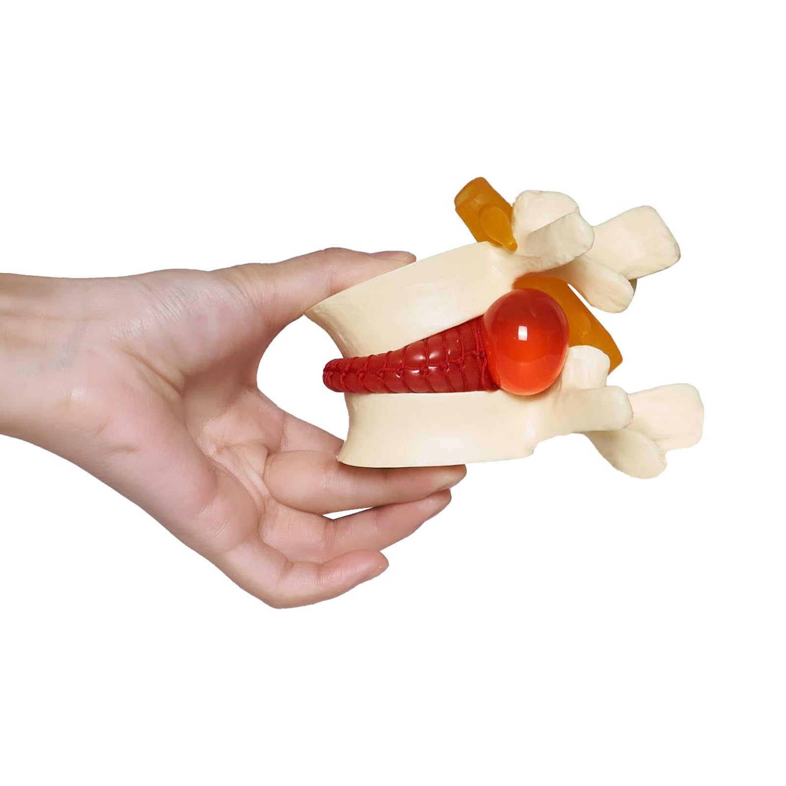 Buy Human Anatomical Lumbar Disc Herniation Model, Portable Herniated ...