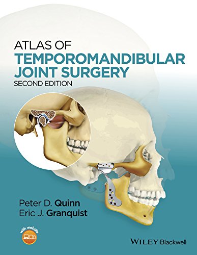 Atlas of Temporomandibular Joint Surgery eBook : Quinn, Peter D ...