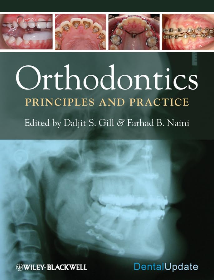 Orthodontics: Principles and Practice: 9781405187473: Medicine & Health ...