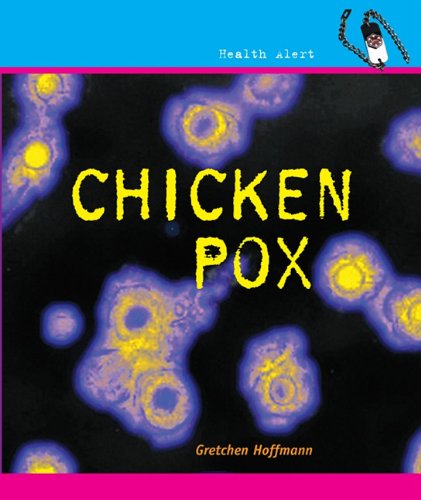 Chicken Pox (Health Alert): Gretchen Hoffmann: 9780761429166: Amazon ...