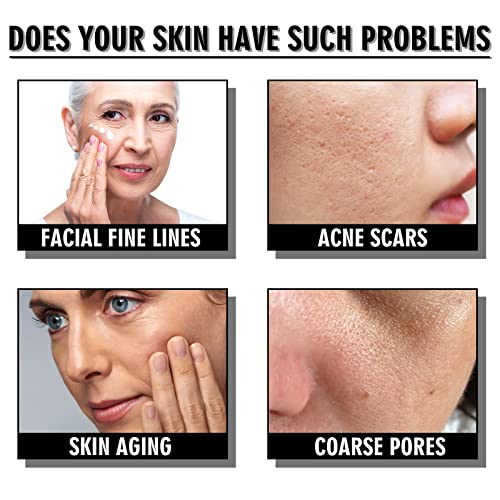 Snail Mucin Repair Cream,Snail Secretion Moisturizer,Snail Cream ...