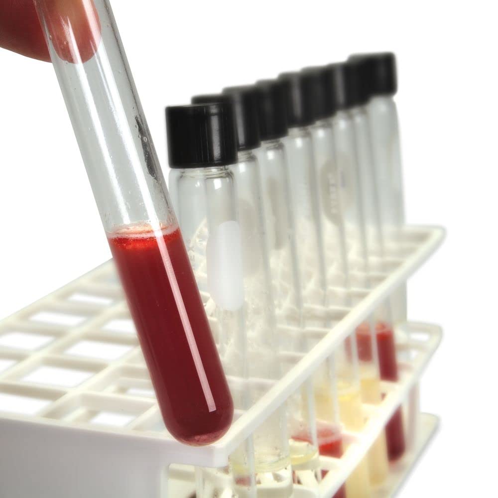 Experimento Controlado Qual A Vantagem De Se Usar Um Experimento