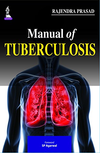 Manual of Tuberculosis - Kindle edition by Prasad, Rajendra, Gupta ...