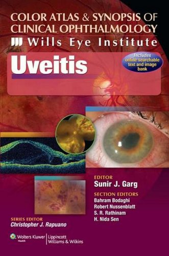 Uveitis:C A & Synopsis Wills Eye Institute: Garg: 9788184737226: Amazon ...