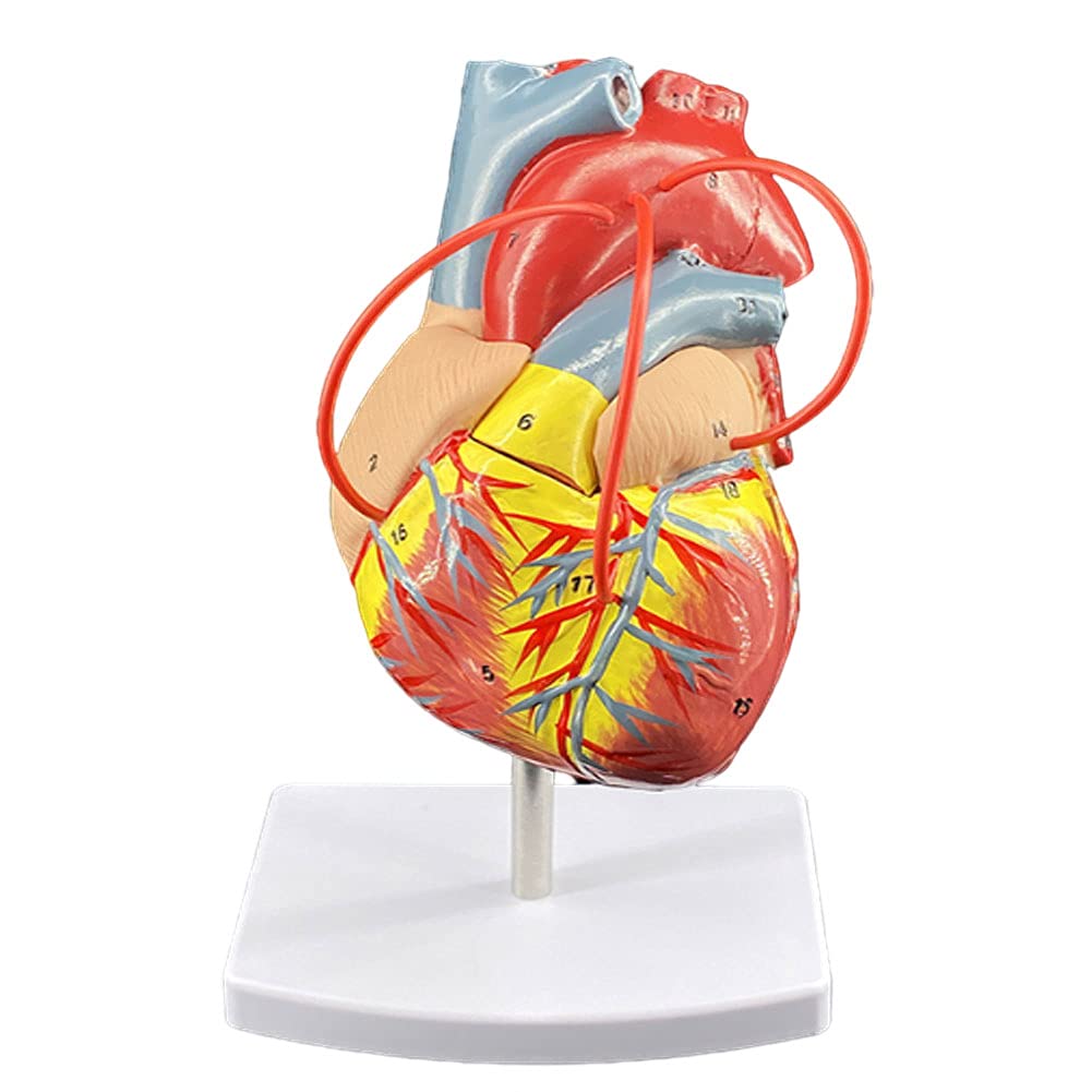 Buy Heart Model with Bypass, Human Organ Anatomical Model, Shows 34 ...