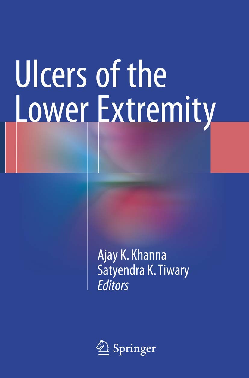 Ulcers of the Lower Extremity: 9788132238034: Medicine & Health Science ...