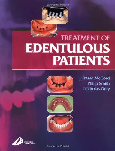 Treatment of Edentulous Patients: 9780443073076: Medicine & Health ...