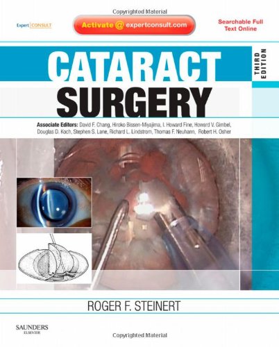 Cataract Surgery (Expert Consult): 9781416032250: Medicine & Health ...