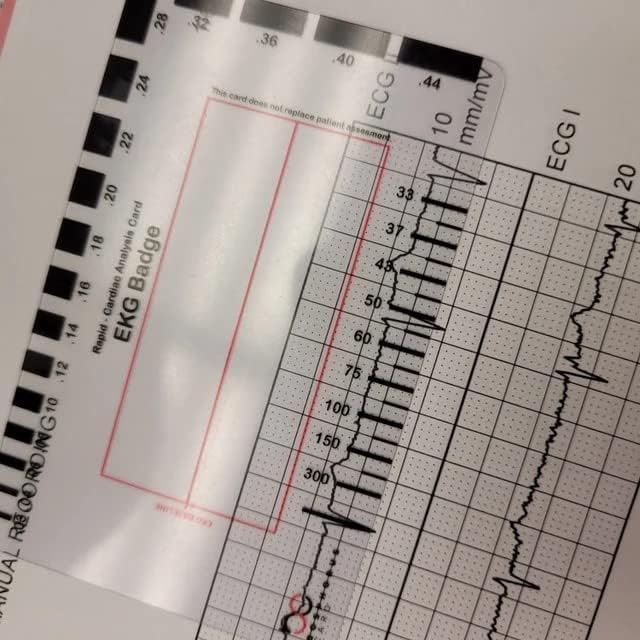 Snapklik.com : EKG PVC Badge Card Accurately Interpret ECG/EKG Rhythm ...