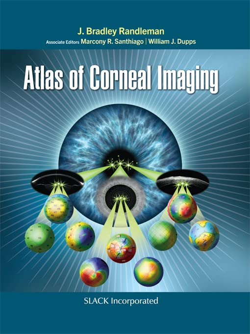 Mastering the Randleman Criteria in Refractive Procedures - Fusion Chat