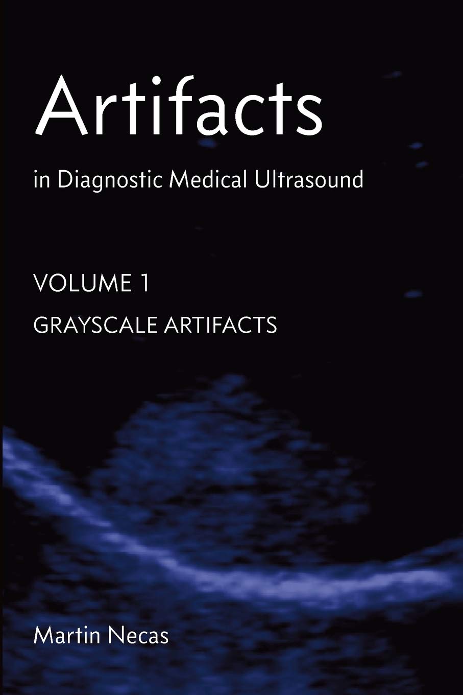 Artifacts in Diagnostic Medical Ultrasound: Grayscale Artifacts ...