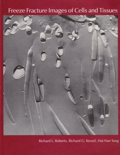Amazon | Freeze Fracture Images of Cells and Tissues | Roberts, Richard ...