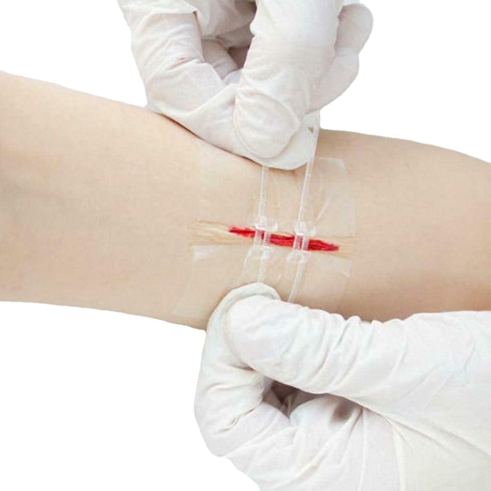 Buy Zipper Band-Aid Adhesive Bandages Emergencyn Zipper Suture-Free ...