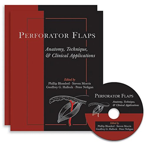 Perforator Flaps: Anatomy, Technique, & Clinical Applications, Second ...