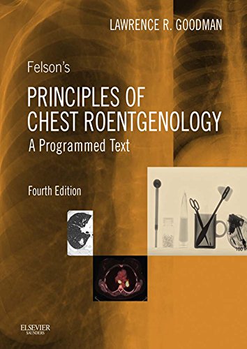 Amazon.com: Felson's Principles of Chest Roentgenology E-Book (Goodman ...