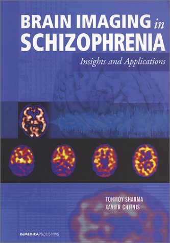 Brain Imaging in Schizophreniained: Insights and Applications ...