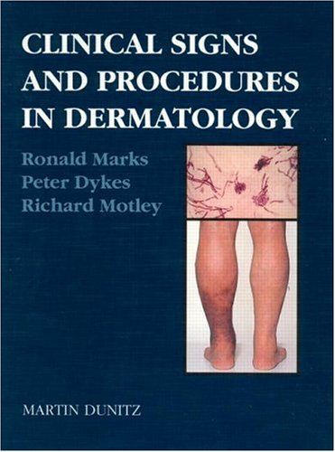 Clinical Signs and Procedures in Dermatology: Amazon.co.uk: Dykes ...