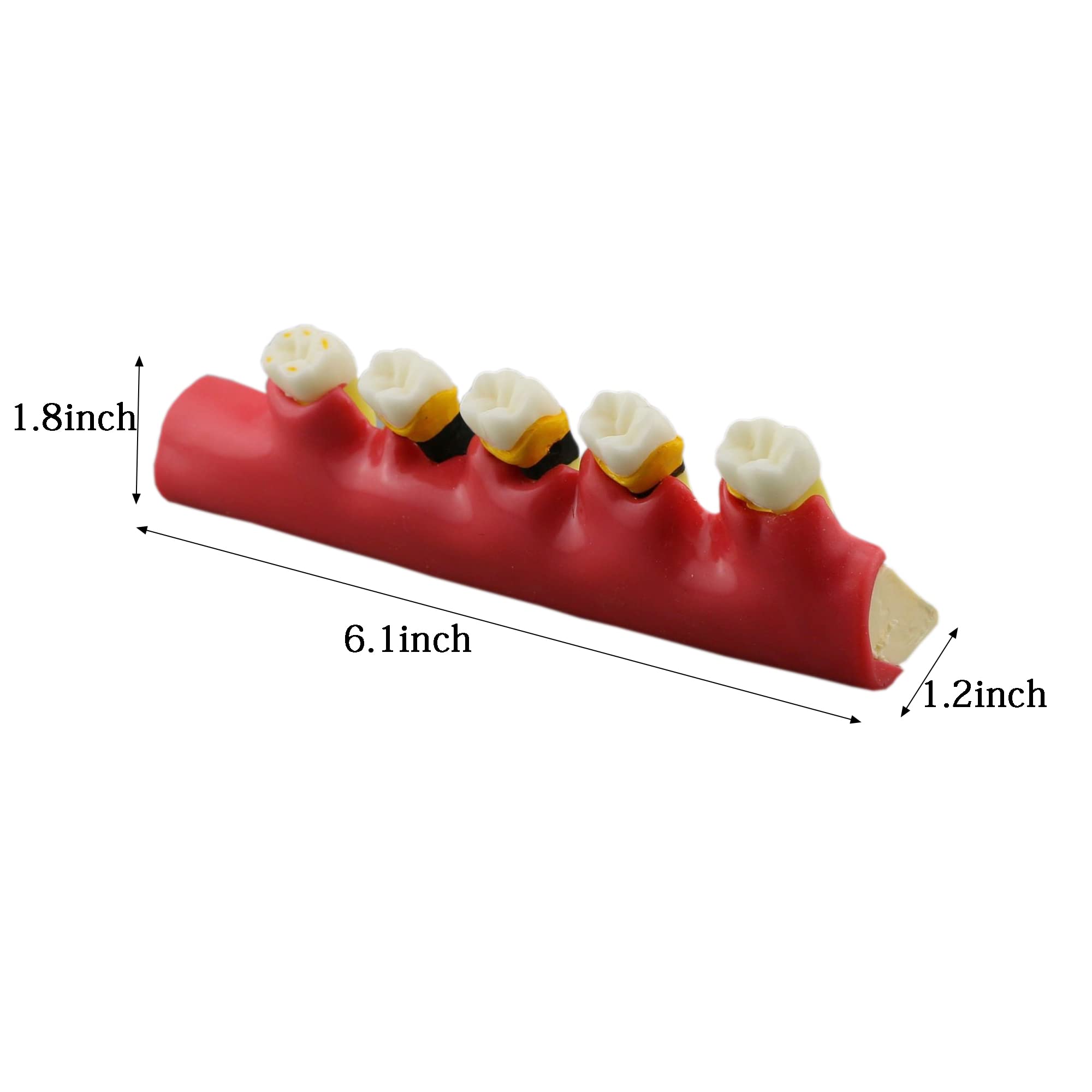 Snapklik.com : Dental Typodont Teeth Model M4010 Demonstrates The ...