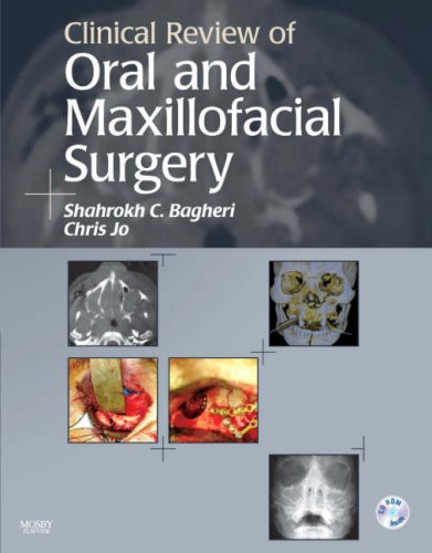 Clinical Review of Oral and Maxillofacial Surgery: 9780323045742 ...