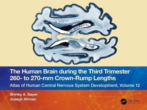Buy The Human Brain during the Third Trimester 260– to 270–mm Crown ...