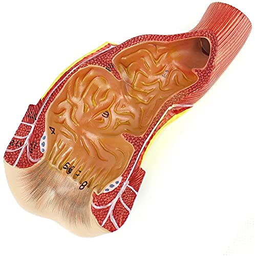 Buy Anatomy Model, Anatomical Structure Model of Human Rectum,Anus Canal - Educational Model ...