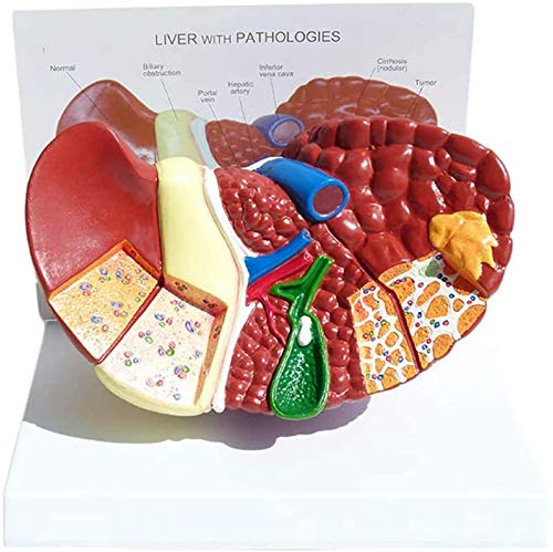 Buy Anatomical Model Of The Human Liver - Structure Anatomical ...