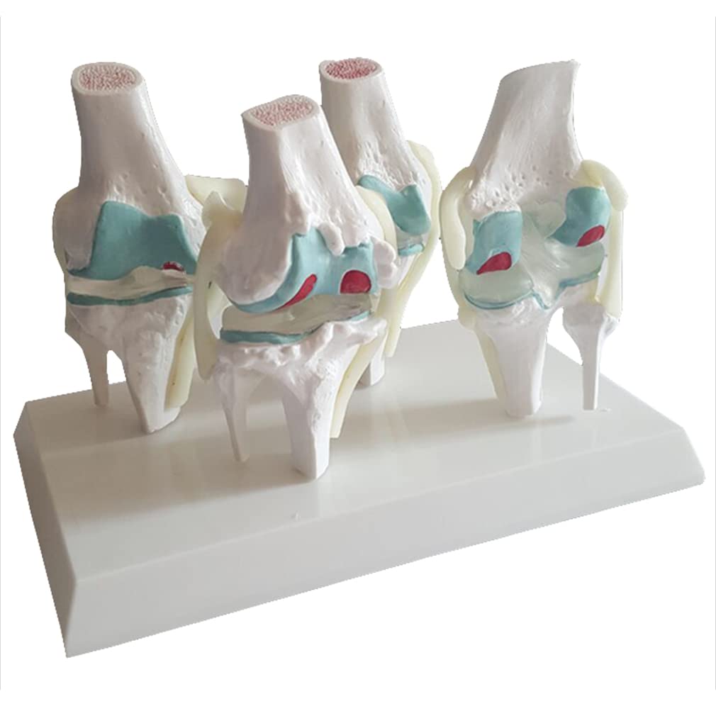 Elbow Joint Ligaments Model
