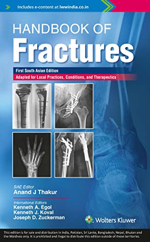 Handbook of fractures, First SAE eBook : Thakur: Amazon.in: Kindle Store