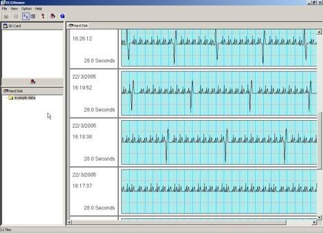 Omron Heart Scan Expansion Pack Software (Without ECG Monitor, Juste Le ...