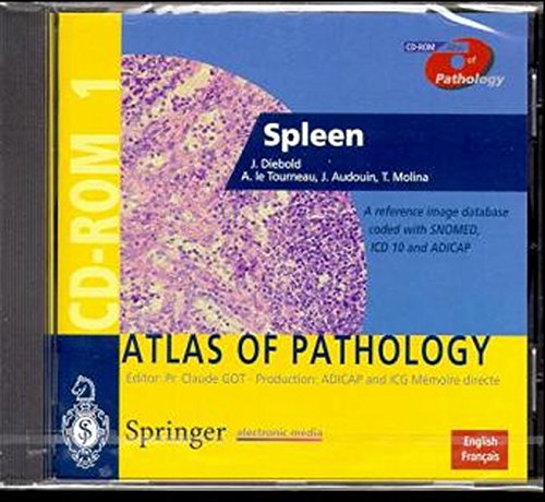 Amazon.com: Spleen (CD-ROM Atlas of Pathology): 9783540146407: Jacques Diebold, A. Le Tourneau ...