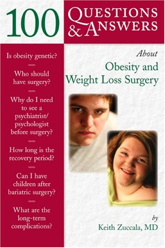 100 Questions & Answers About Obesity & Weight Loss Surgery ...