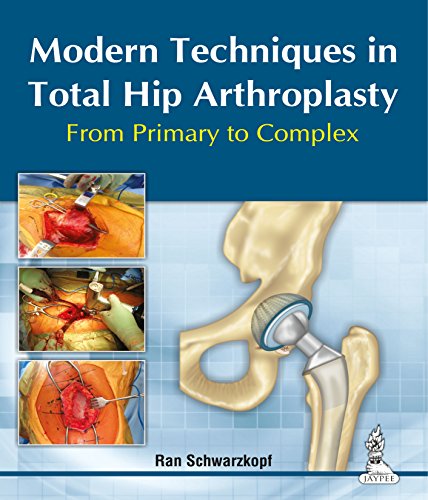 Modern Techniques in Total Hip Arthroplasty From Primary to Complex ...