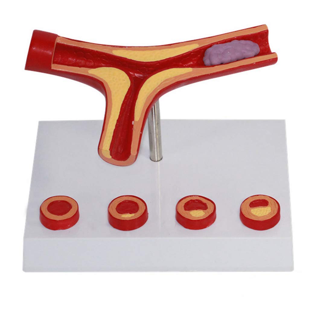Buy DBSCD Anatomical Human Blood Vessel Model - Blood Vessel Model ...