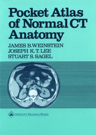 Amazon.com: Pocket Atlas of Normal Ct Anatomy: 9780881670707: Weinstein ...