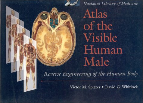 Amazon.com: ATLAS OF VISIBLE HUMAN MALE- PAPER: .: 9780763703479 ...